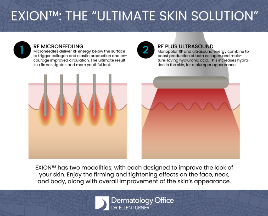 Exion | Dallas, Irving, Texas | The Dermatology Office